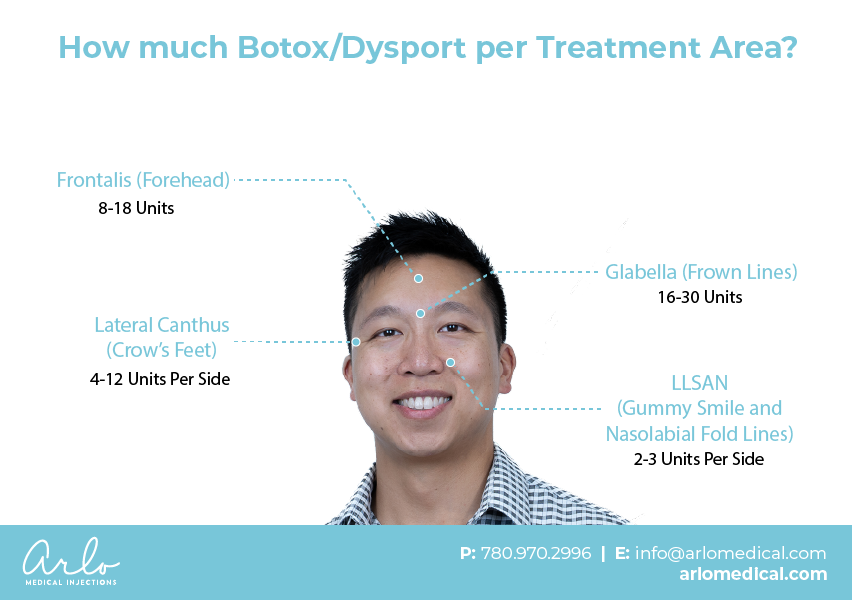 How Many Botox Units Do You Need? | Arlo Medical How Many Botox Units Do You Need? | Arlo Medical